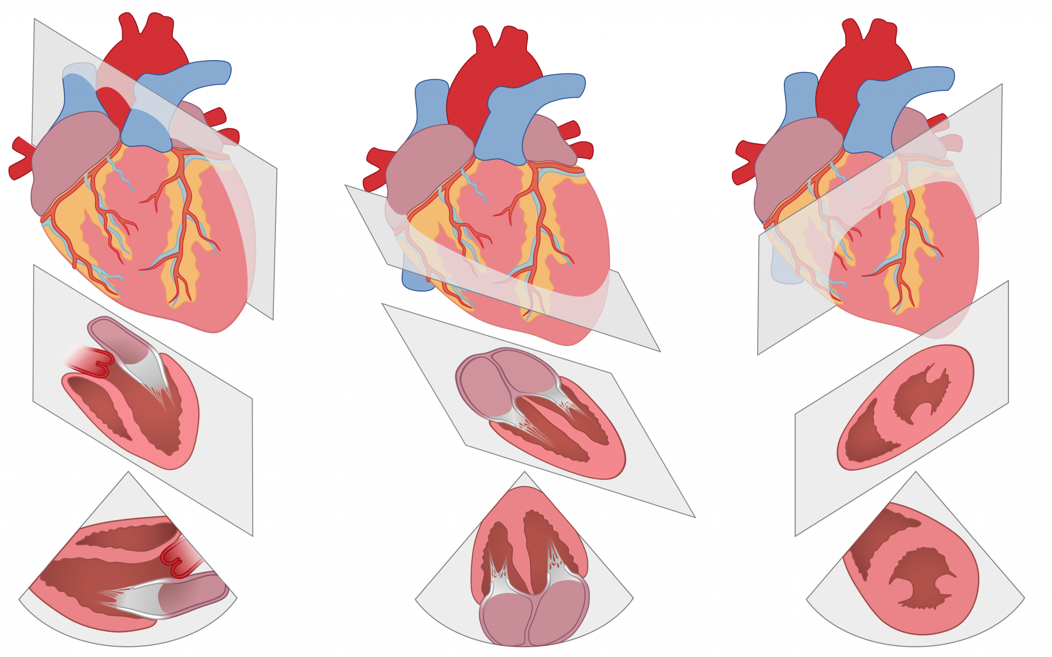 Module 2: Cardiac POCUS → Cardiac Ultrasound Theory & Principles ...